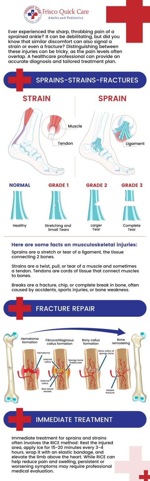 Sprains And Strains Treatment at Frisco Quick Care in Frisco, TX